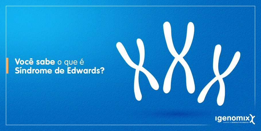 Conheça a Síndrome de Edwards, que afeta 1 em cada 5 mil bebês - Nace ...